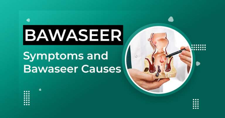 Symptoms And Causes Of Bawaseer In English And Urdu Best General